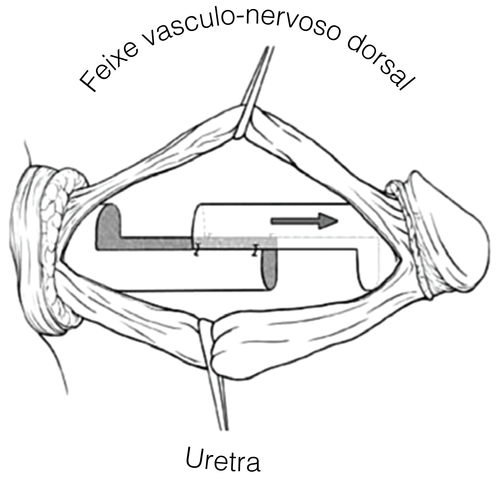 Prótese Peniana - Dr. Alexandre Miranda / Andrologia & Urologia Prótese Peniana - Dr. Alexandre Miranda / Andrologia & Urologia